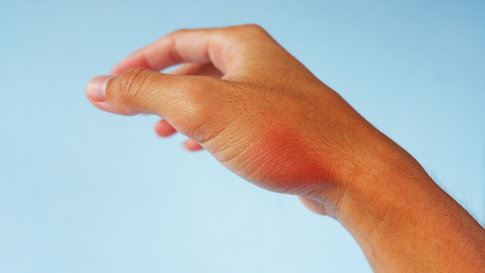 Understanding Arthritis: Causes, Symptoms, and Treatment Options ...